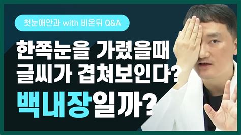 한쪽 눈을 가리고 봤을 때 겹쳐보이거나 흐리게 보인다면 백내장일까 Youtube