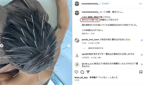 窪田正孝がおかしくなったと言われる3つの理由【激痩せ•菜食•ルート】 Trend New Blog