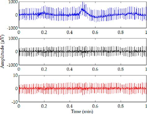 Figure 1 From A Sleep Apnea Detection System Based On A One Dimensional Deep Convolution Neural