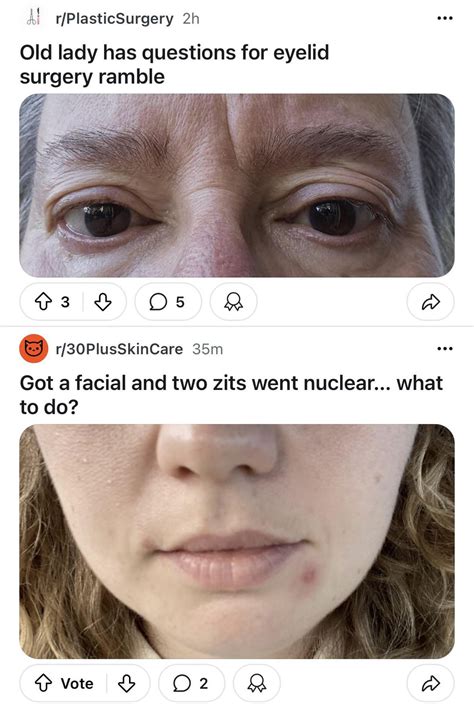 My Reddit Feed Rinteresting