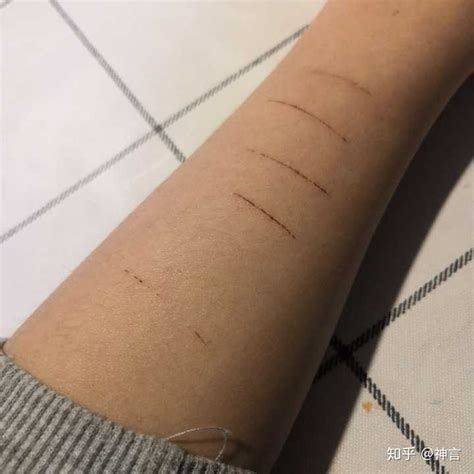 什么程度叫的上自残 分手后自的图片 自图片 第12页 大山谷图库