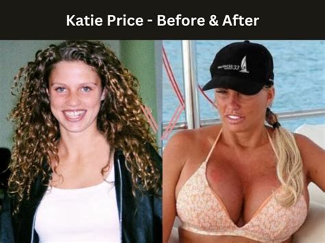 Celebrities With Breast Implants Before And After Photos Vantage Clinic Cosmetic Surgery