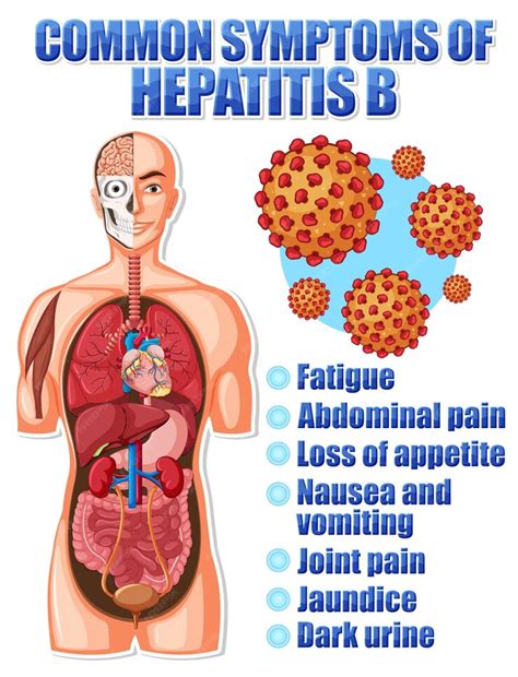 Free Vector Informative Poster Of Common Symptoms Hepatitis B