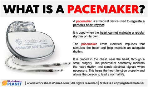 What Is A Pacemaker
