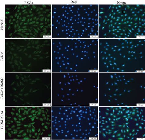 Cinaciguat Alleviates T2dm Induced Osteogenesis Injury By Upregulating
