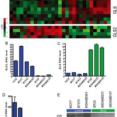 Glutamine Addiction Phenotypes Among Different Breast Cancer Cell
