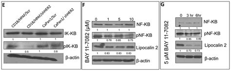 MUC mediated regulation of lipocalin via AKT NF κB pathway Download Scientific Diagram