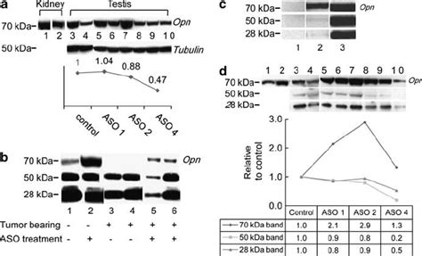 Effect Of Osteopontin Opn Expression By An Download Scientific