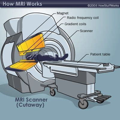 How MRI Works Diagnostic Imaging Mri Magnetic Resonance Imaging