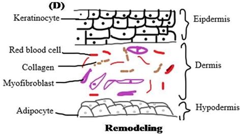 1 Schematic Diagram Of The Wound Healing Process Of A Haemostasis