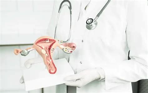 Histerectomía Cirugía Ginecológica Oncológica