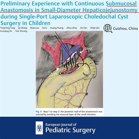 European Journal Of Pediatric Surgery And Reports On Linkedin Hepaticojejunostomy Choledochal