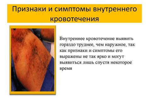 Оказание первой помощи презентация онлайн