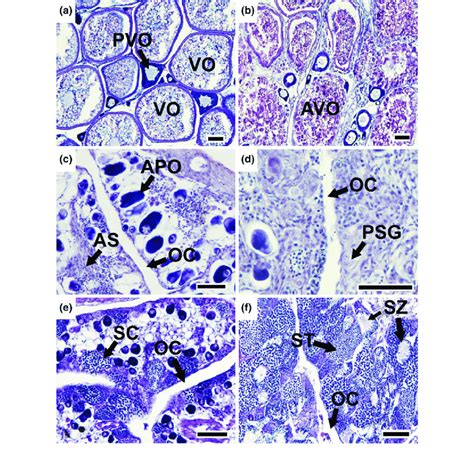 Process Of Gonadal Sex Change Induced By Female Pairs A Stage Download Scientific Diagram