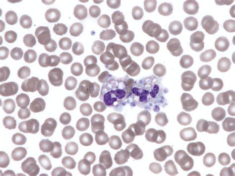 Platelet Phagocytosis By Neutrophils Stock Image Image Of Platelet Wright 364263949
