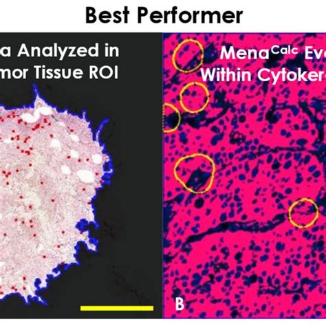Graphic Representation Of Restricted Mean Survival Time And Its Download Scientific Diagram