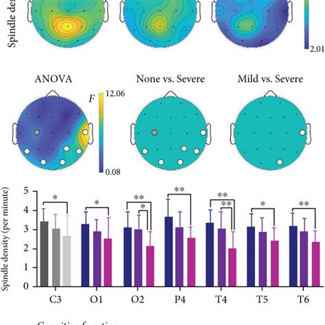 Spindle Characteristics During N2 Sleep First Row Of Each Graphic The