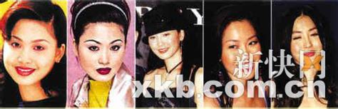 明星整容再爆危机 周汶琦半边面瘫？图 搜狐娱乐