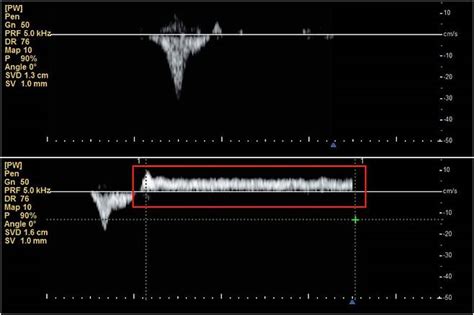[없는 병도 만드는 병원들]① 하지정맥류 심각하다더니 아무것도 없었다