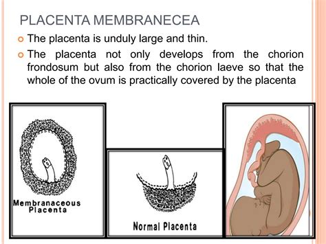 Abnormalities Of Placenta And Cord Pptx