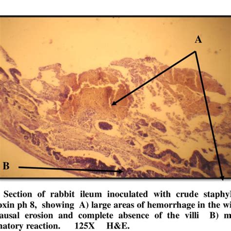 ligated segments of rabbit ileal loop after injection with crude