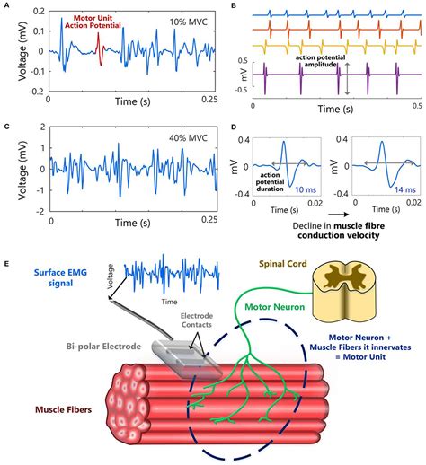 Frontiers Analysis And Biophysics Of Surface Emg For Physiotherapists And Kinesiologists