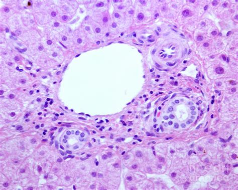 Portal Area Of Human Liver Photograph By Jose Calvo Science Photo