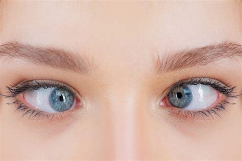 Convergence Excess Symptoms Causes Diagnosis And Treatment