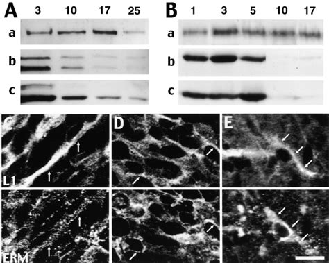 Immunoblots Indicate That Ezrin And Moesin Expression Levels Are