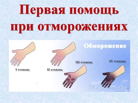 Первая помощь при термических поражениях презентация онлайн