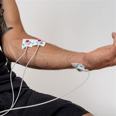 Electrodes Placement Upper Limb Egzotech Empowering Physiotherapy