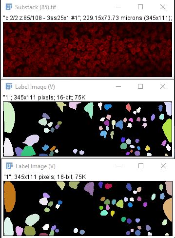 Bioinformatics Suggestion On Program Algorithm To Segment Nuclei