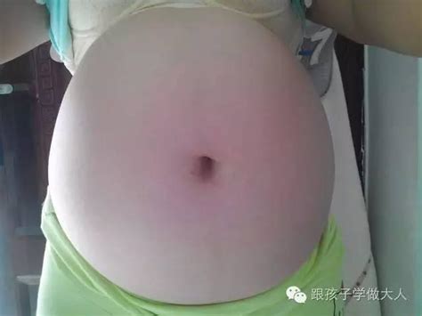 孕期患有此病臍帶可能和羊水一起湧出！胎兒十分危險！ 每日頭條