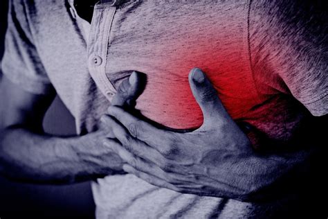 Cresce Número De Infartos Entre Jovens No Brasil Saiba Prevenir