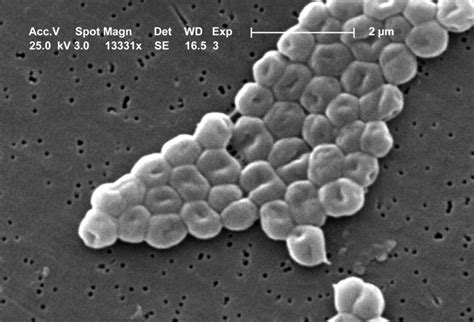 Acinetobacter Baumannii Gram