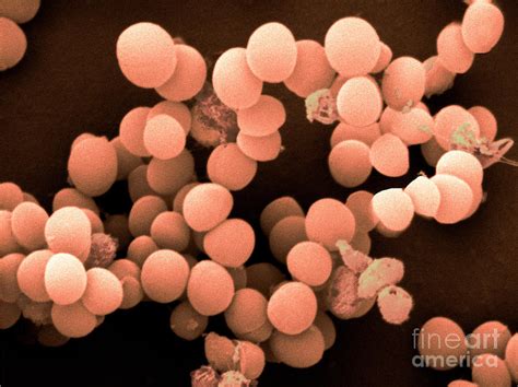 Staphylococcus Saccharolyticus Photograph By Scimat Fine Art America