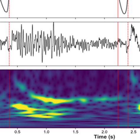 Modulation Of Beta And Gamma Oscillation Power By The Phase Of The Download Scientific Diagram
