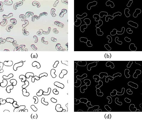 Edge Detection Of Microscopic Image Of Cotton Fiber Cross Section Using
