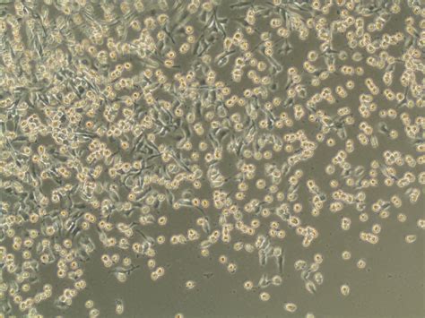 Questions With Answers In MDA MB CELL LINE Science Topic
