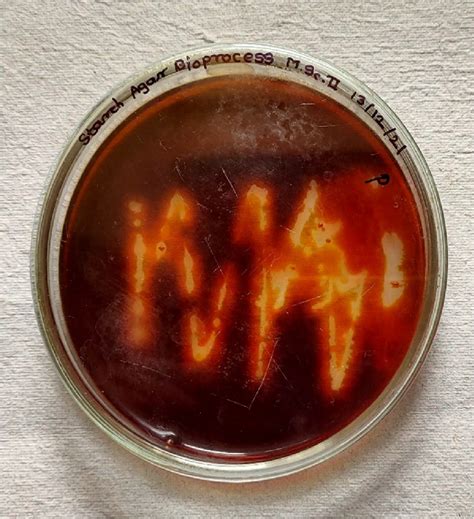 Positive Starch Hydrolysis Test Download Scientific Diagram
