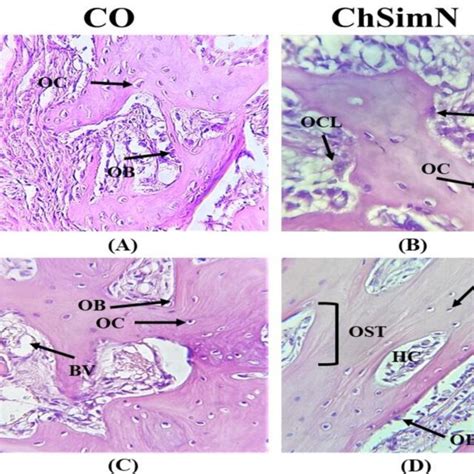 Histological Section Of The Bone Defect Stained With Hande A Control