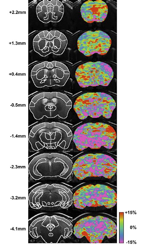 Functional Magnetic Resonance Imaging Suggests Brain Region Specific Download Scientific