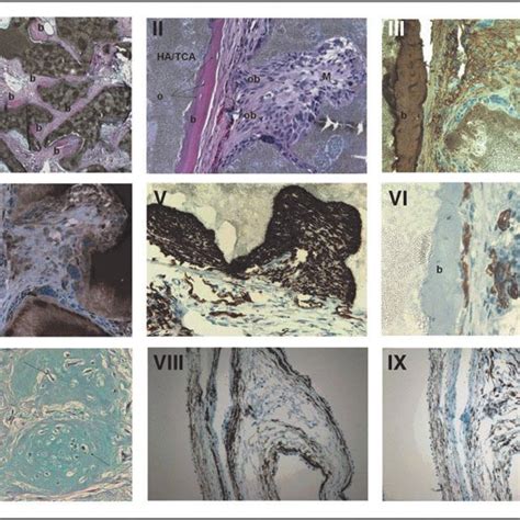 Differentiation Of Human Embryonic Stem Cells Hescs As Human Embryoid