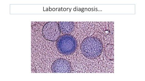 Dimorphic Systemic Mycoses Pptx