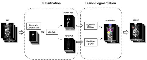논문 리뷰 Enhancing Lesion Segmentation in PET CT Imaging with Deep Learning and Advanced Data