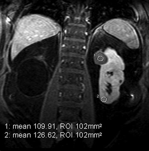 Renal Dynamic Imaging