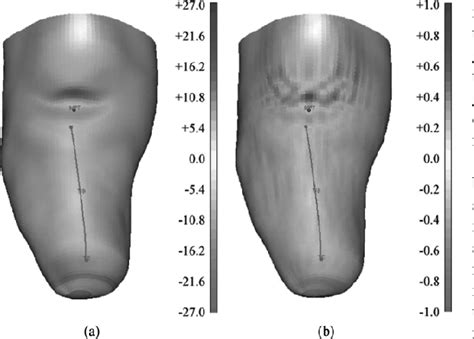 Figure 4 From A Method For Aligning Trans Tibial Residual Limb Shapes So As To Identify Regions