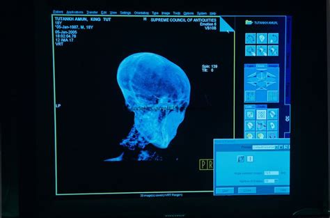 Ct Scan Of Tutakhamun S Mummy Skull Tutankhamun And The Golden Age Of
