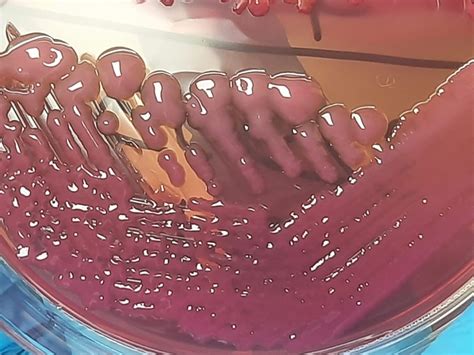 Acinetobacter Baumannii Treatment Archives Medical Notes