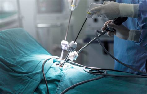 Minimally Invasive Surgery Dr Mdaka Obstetrician And Gynaecologist In